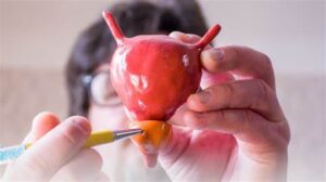 RTU Próstata [ 2025 ] – Clinicas Popular